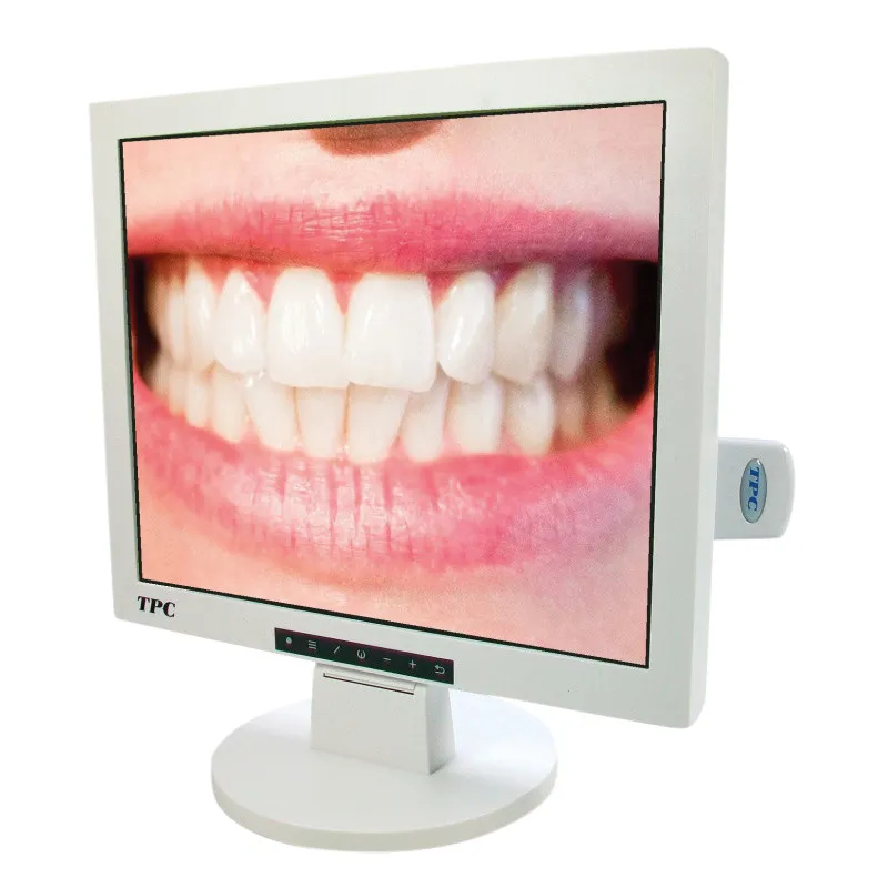 MONITOR TPC 17 | Umbra